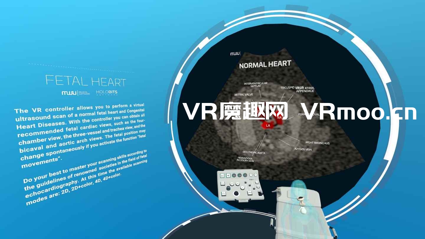 Oculus Quest 游戏《Fetal Heart VR》心脏病医学VR – VR魔趣网